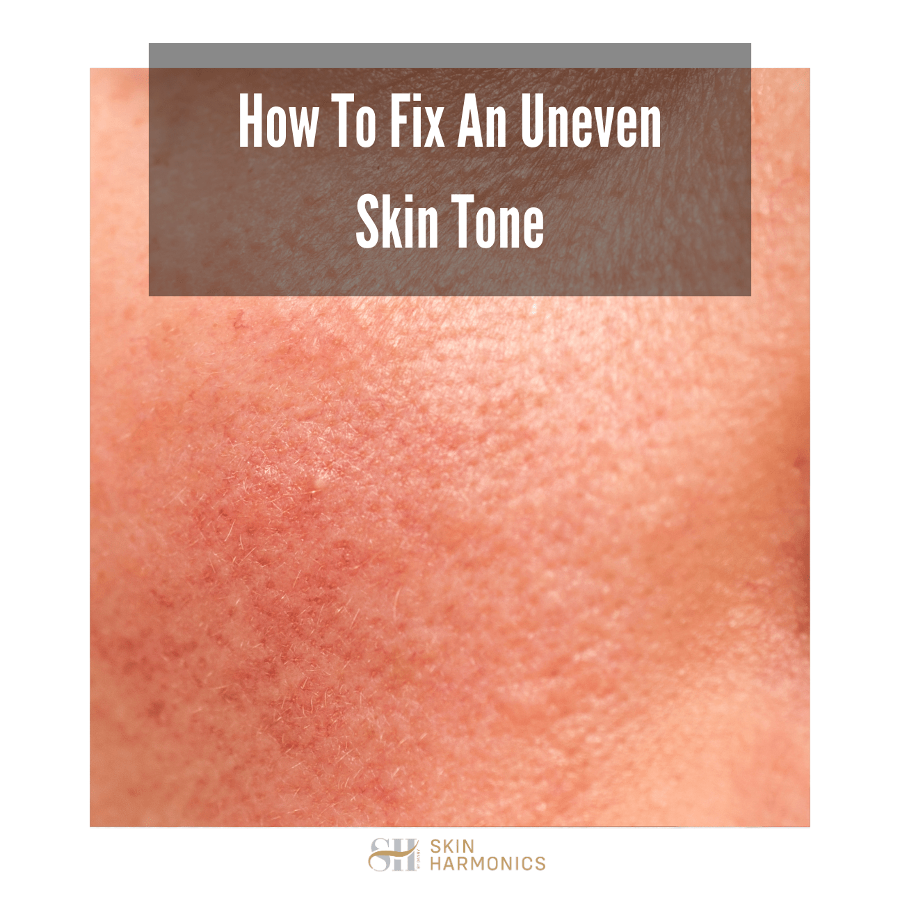 What Are Beauty Marks? - Skin Harmonics